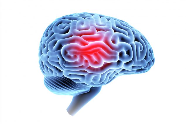 Growth Hormone Deficiency and Traumatic Brain Injury | American ...